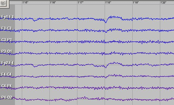 To The Rhythm of Your Brain – SQ Online